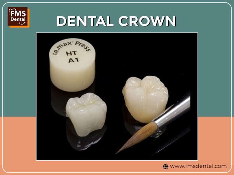 Why Do We Place a Crown After Root Canal Treatment? Is It Necessary ...