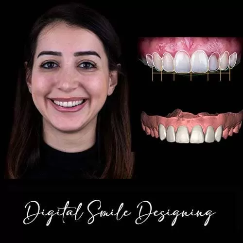 Smile Makeover in Hyderabad, India | Cosmetic Dentistry | FMS